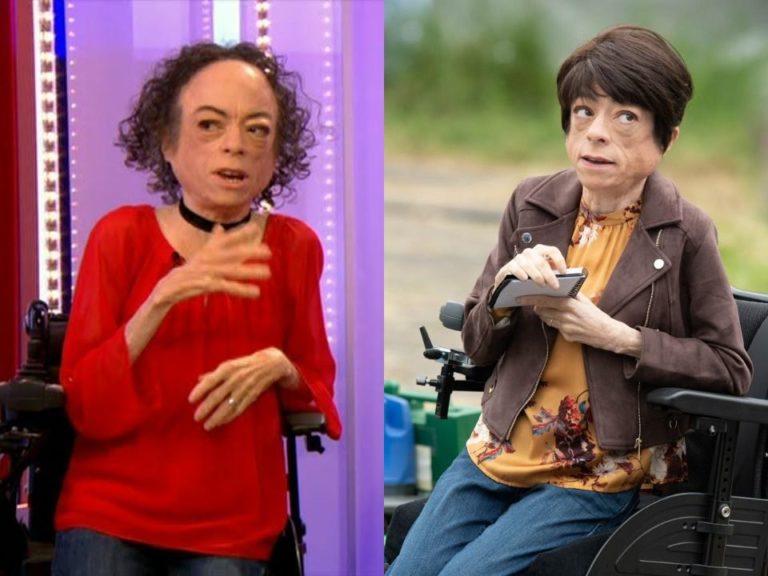Liz Carr Biography, Age, Height, Husband, Net Worth - StarsWiki